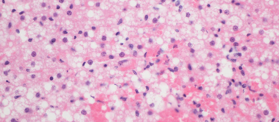 Collins Lab Research-New | Vanderbilt University Medical Center